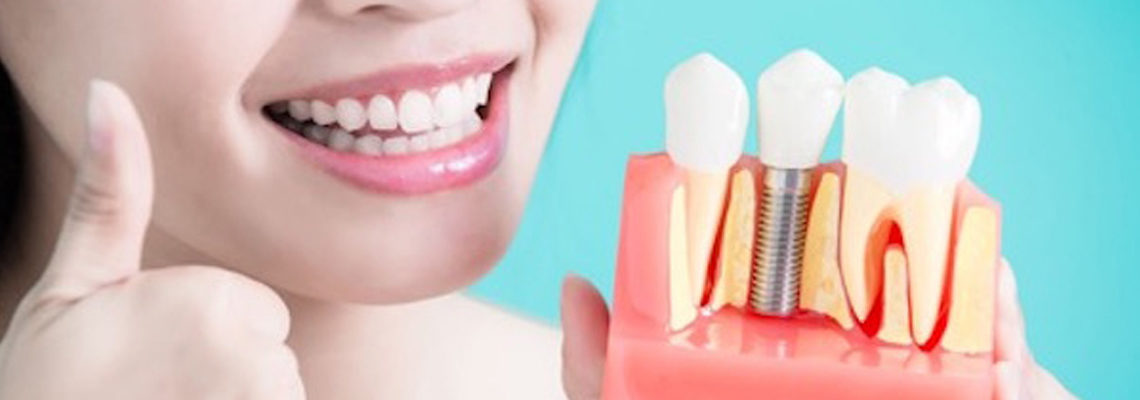 In-Depth Analysis Of Basal Implants And Why You Need Them