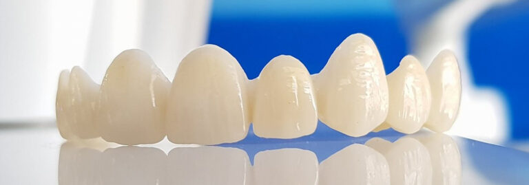 The Latest Innovations in Dental Implant Technology | Dr. Motiwala