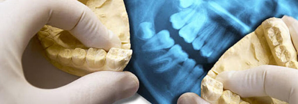 The Role of Dentistry in Forensic Science | Dr. Motiwala