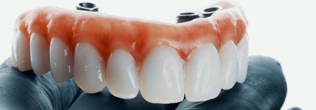 Hybrid Dentures vs. Traditional Dentures: Which Is Right for You? | Dr ...