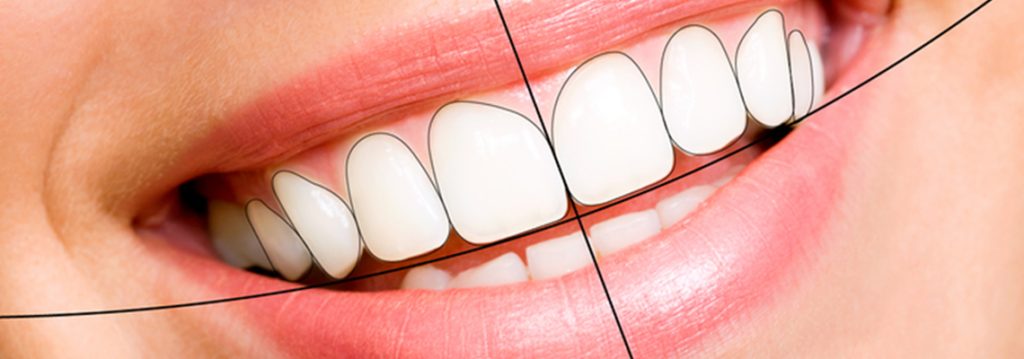 The Art of Smile Makeovers: Where Science Meets Creativity | Dr. Motiwala